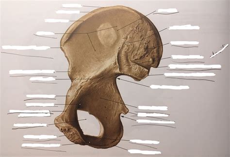 Pelvis 410 Diagram Quizlet