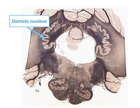 Dentate Nucleus
