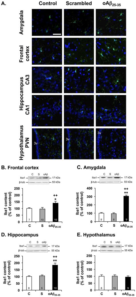 A Effects Of Oaβ25 35 10 µg Rat Icv Injection On Microglial Reaction Download Scientific