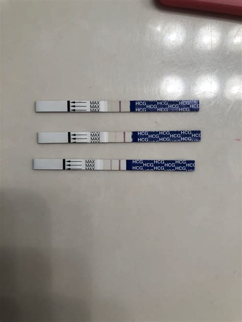 Ectopic Pregnancy Test Progression Captions Trend Today