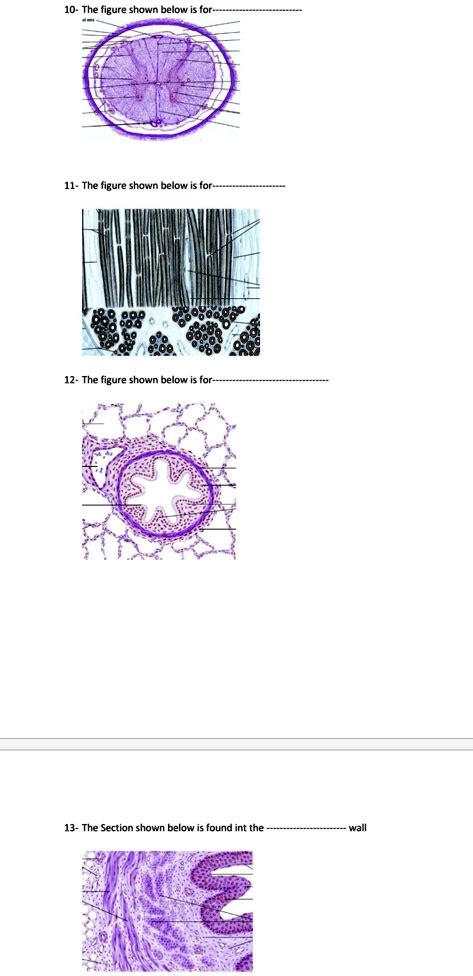 The Figure Shown Below Is For The Figure Shown Below Is For The Figure Shown Below