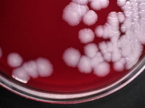 In Key Anthrax Test Scientist Just Threw Out Test Tube Showing Sample