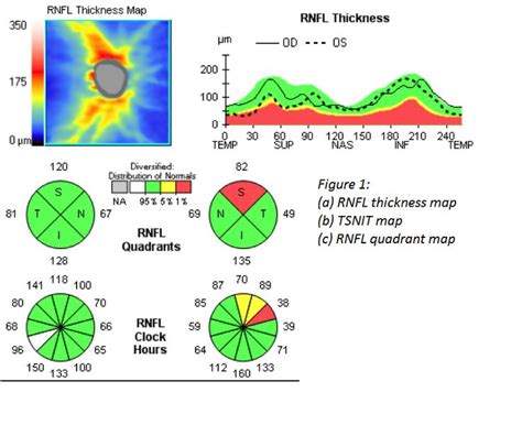 Optical Coherence Tomography Basics Neryuniversal