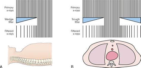 X Ray Beam Filtration The Best Picture Of Beam
