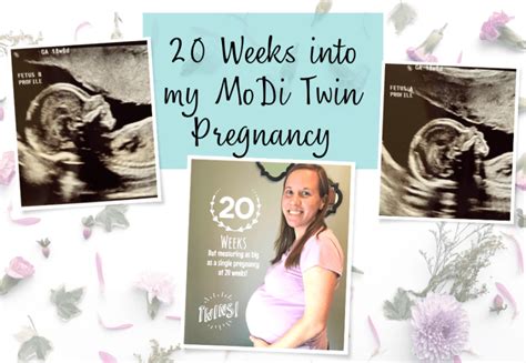 What Life Was Like When I Was Weeks Pregnant With Twins The Way It Really Is