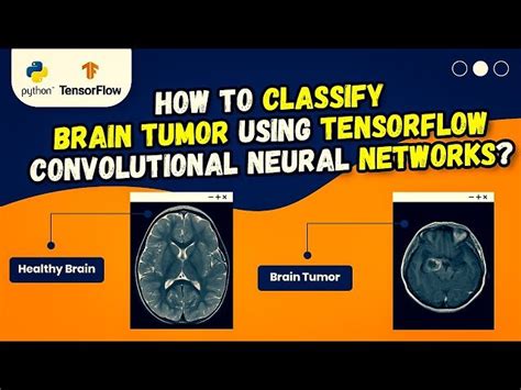 Free Video Cancer Detection In Brain Using Deep Learning From Eran Feit Class Central
