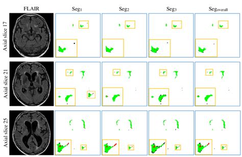Detailed Segmentation Results Of Three Models And The Ensemble Columns