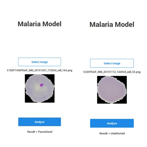 GitHub IArunava Malaria Detection Using Keras Malaria Detection Using Deep Learning From