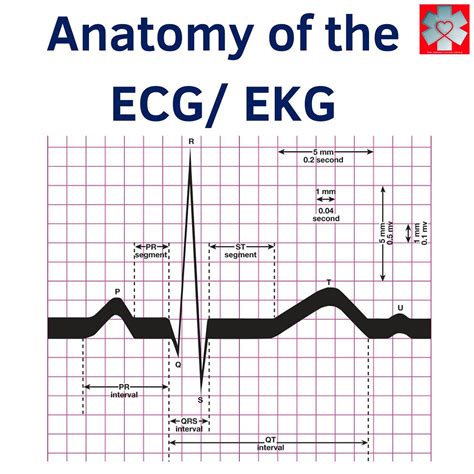 Anatomy Of The Ecg Ekg And 5 Step Method Of Interpretation