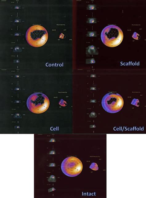Defect Size In All Groups Detected By Spect A Color Figure Can Be