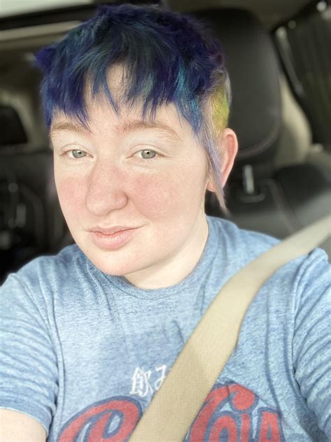 1yr Hrt Before And After Ftm Rtrans