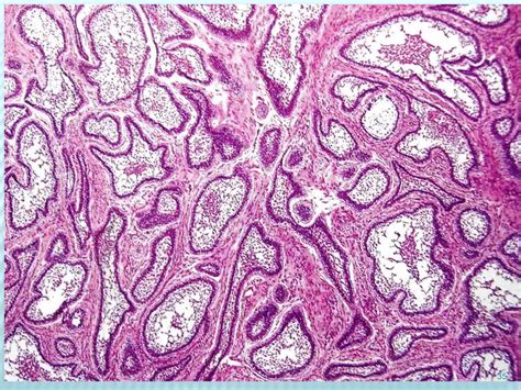 Odontogenic Tumor 2022pptx Dental Health Diseases And Conditions