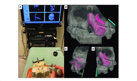 Advanced Intraoperative Navigation System A Setup Of The System Download Scientific