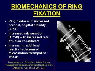 G11 Principles Of External Fixationpdf