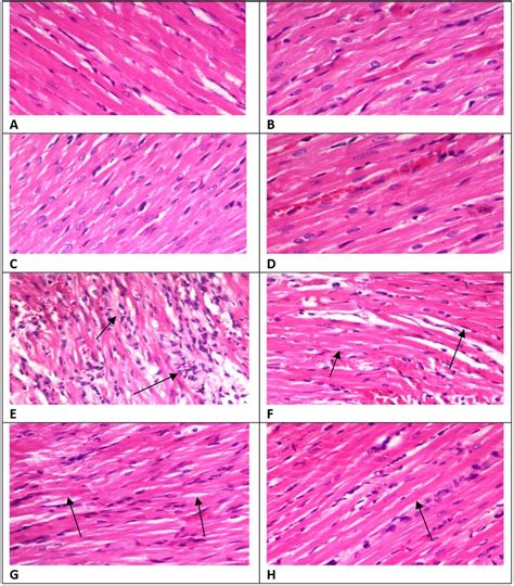 Cardiac Muscle Histology