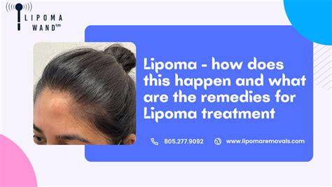 Lipoma How Does This Happen And What Are The Remedies For Lipoma