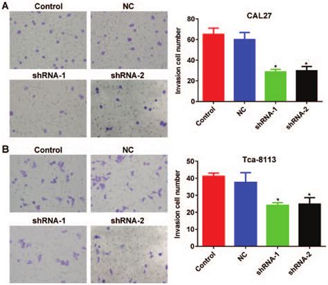 Inhibition Of Lncrna Pcat 1 Reduces The Invasiveness Of Tongue Squamous Download Scientific
