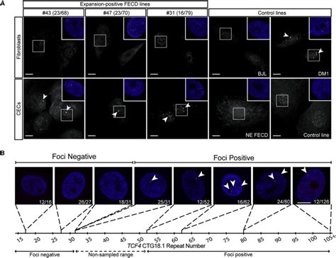 Ctg18 1 Associated Rna Foci Occur In A Tissue Specific Manner A Download Scientific Diagram