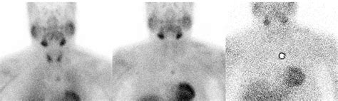 Mir Teaching File Case Pa005