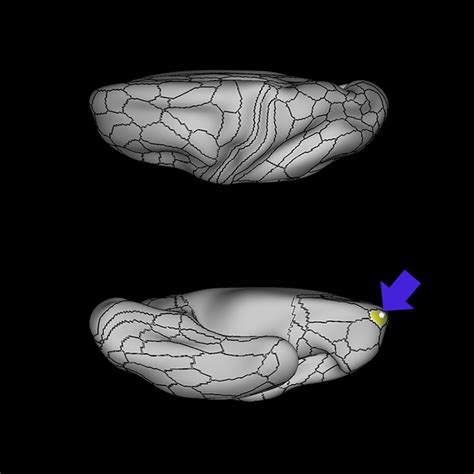 Limbicparalimbic System Connectome Guide