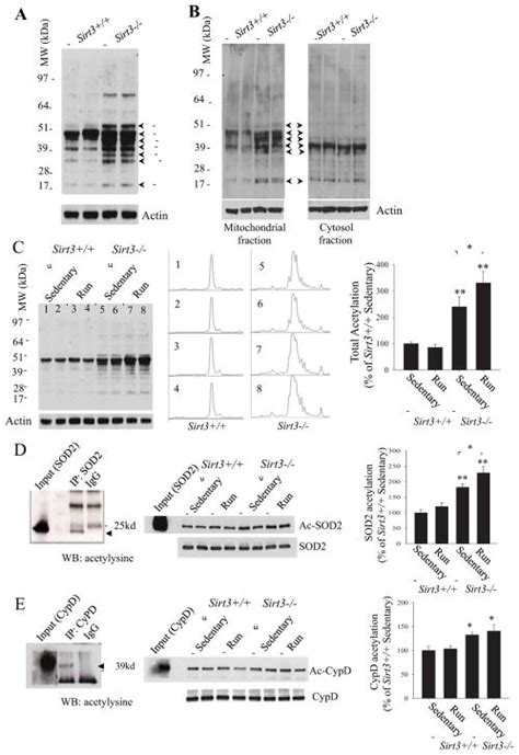 Mitochondrial Sirt3 Mediates Adaptive Responses Of Neurons To Exercise And Metabolic And