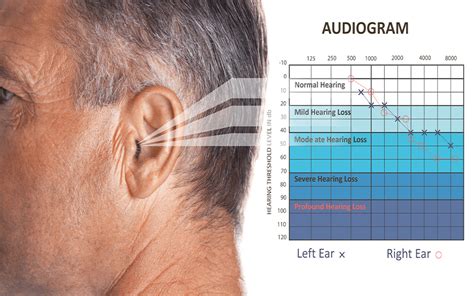 A Guide To Understanding Audiograms