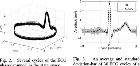 figure 1 from a nonlinear bayesian filtering framework for ecg