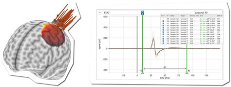 Brainsight TMS Navigation Brainbox