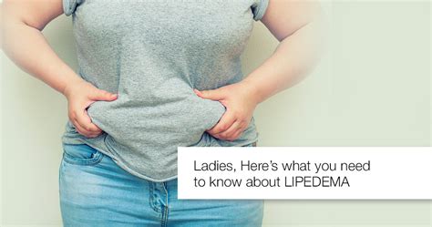 Lipedema Symptoms Causes And Treatment Apollo Hospitals