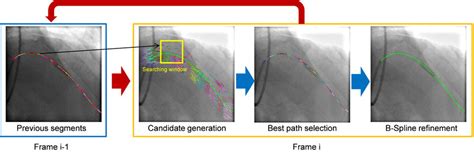 Overview Of Proposed Tracking Framework Download Scientific Diagram