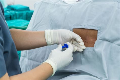 Epidural Steroid Injections For Sciatica Total Ortho Sports Medicine