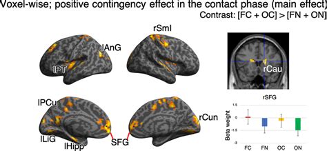 Brain Activation Representing A Positive Contingency Effect Brain