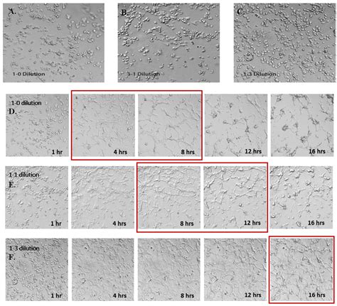 Fig 5 Vitrogel Angiogenesis Assay Kit App Note Thewell Bioscience