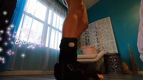 Leg Cast And Sprained Ankle By Mile High Mikayla Clips4sale