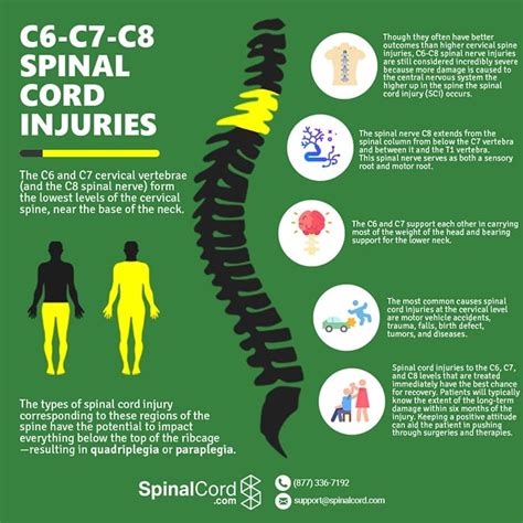C6 C7 And C8 Spinal Injuries Know This About Cervical Spine Fractures