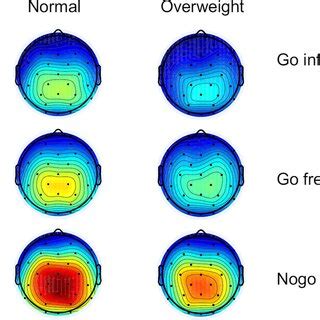 Scalp Voltage Maps For Each Of The Trials In Normal Weight Left And Download Scientific