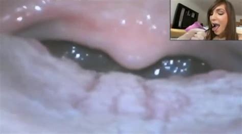 Endoscope Mouth Cum