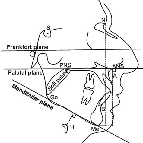 Upper Airway Boundaries And Measurements Of The Upper Airway Shape Download Scientific Diagram
