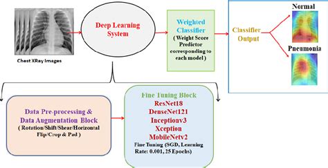 Figure 3 From Efficient Pneumonia Detection In Chest Xray Images Using Deep Transfer Learning