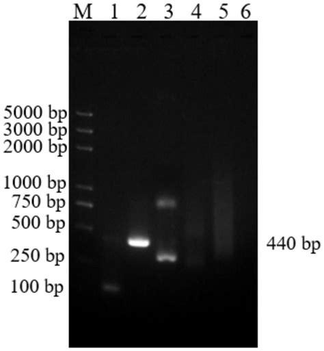 Triple Rpa Recombinase Polymerase Amplification Detection Kit For