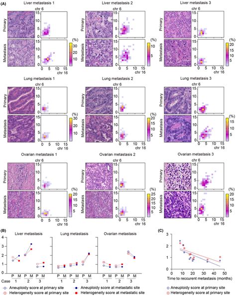 Ploidy Alteration Of Cancer Cells In Relapsed Tumors A Hande Staining Download Scientific