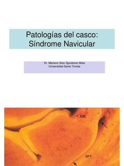 Síndrome Navicular En Equinos Pdf Hueso Especialidades Medicas