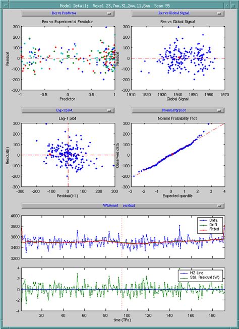 NISOx SPMd Example Multiple Condition