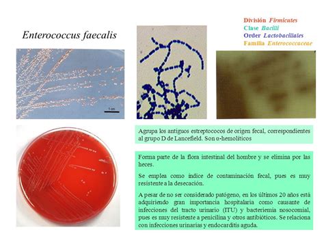 Enterococcus Faecalis Antibiotic Sensitivity
