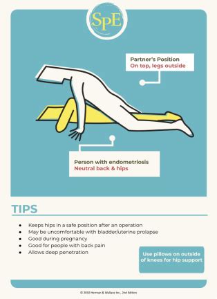 Endometriosis And Sex How To Explore Painful Pleasure