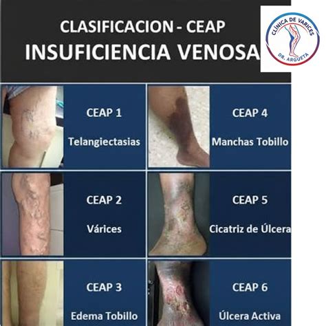 Clínica De Varices Dr Argueta San Salvador