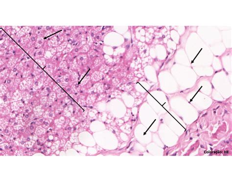 Tecido Adiposo Unilocular E Multilocular Quiz