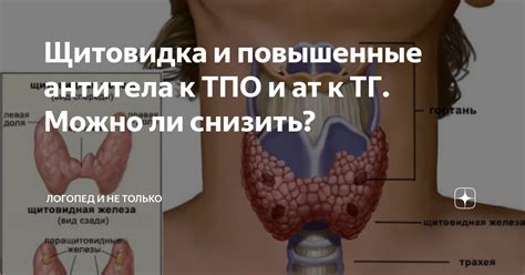 Щитовидка и повышенные антитела к ТПО и ат к ТГ Можно ли снизить Логопед и не только Дзен