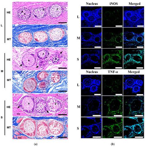 Development Of In Situ Microfluidic System For Preparation Of Controlled Porous Microsphere For