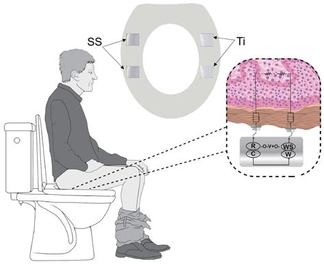 Dependence Of Skin Electrode Contact Impedance On Material And Skin Hydration